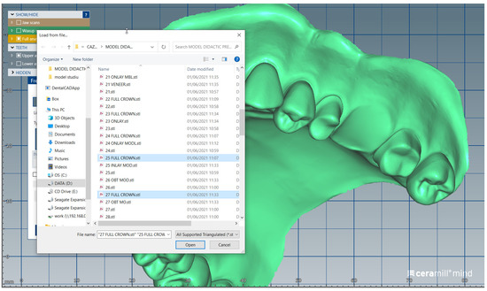 Medicina | Free Full-Text | Modular Digital and 3D-Printed Dental ...