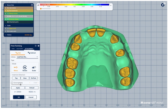 Medicina | Free Full-Text | Modular Digital and 3D-Printed Dental ...