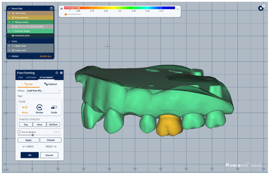 Medicina | Free Full-Text | Modular Digital and 3D-Printed Dental ...