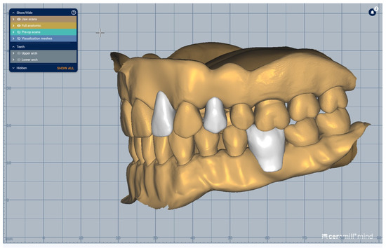 Medicina | Free Full-Text | Modular Digital and 3D-Printed Dental ...