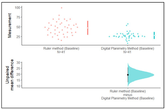 Comparison of Digital Planimetry and Ruler Methods for the Measurement ...
