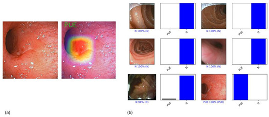 Deep-Learning and Device-Assisted Enteroscopy: Automatic Panendoscopic Detection of Ulcers and ...