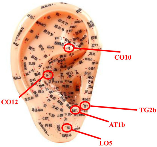 Auricular Acupressure for Dry Eye Disease: A Systematic Review and Meta ...