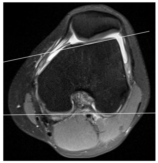 Medicina | Free Full-Text | Morphometric Parameters and MRI ...