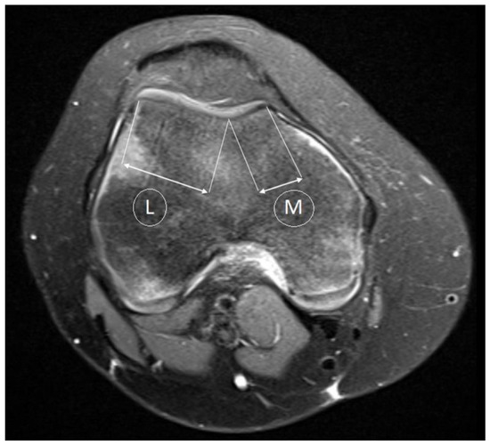 Medicina | Free Full-Text | Morphometric Parameters and MRI ...