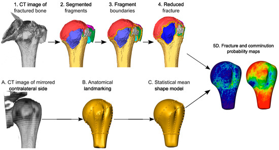 Statistical Morphology and Fragment Mapping of Complex Proximal Humeral ...