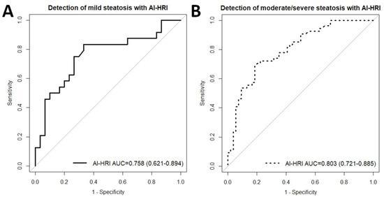 Evaluation of Artificial Intelligence-Calculated Hepatorenal Index for ...
