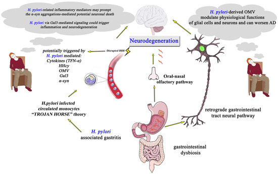 Controlling the Impact of Helicobacter pylori-Related Hyperhomocysteinemia on Neurodegeneration
