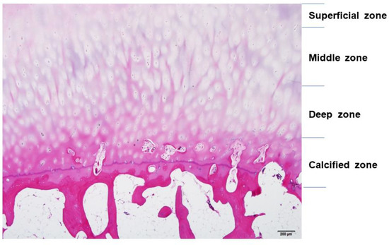 Autologous Collagen-Induced Chondrogenesis: From Bench to Clinical ...