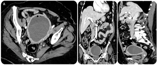Medicina | Free Full-Text | Management of Pyometra Using a Novel Image ...