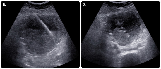 Management of Pyometra Using a Novel Image-Guided Percutaneous ...