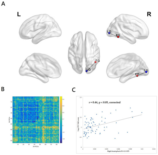 Resting-State EEG Connectivity at High-Frequency Bands and Attentional Performance Dysfunction ...