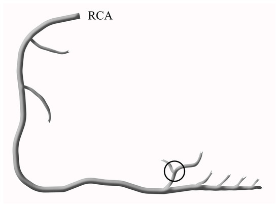 Predictors of Long-Term Mortality in Patients with Stable Angina Pectoris and Coronary Slow Flow
