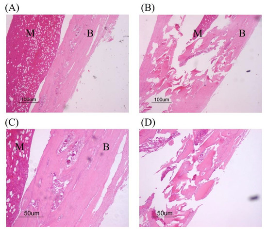 Efficacy of Silver Nanoparticles-Loaded Bone Cement against an MRSA ...