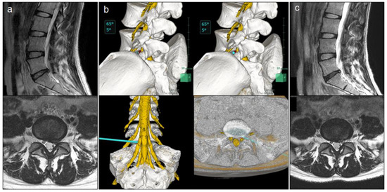 Medicina | Free Full-Text | Evaluation of Surgical Indications for Full ...