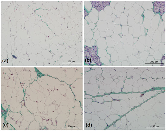 Alteration of Collagen Content and Macrophage Distribution in White ...