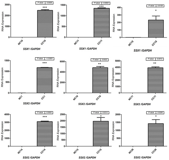 Medicina | Free Full-Text | Higher Expression Levels of SSX1 and SSX2 ...