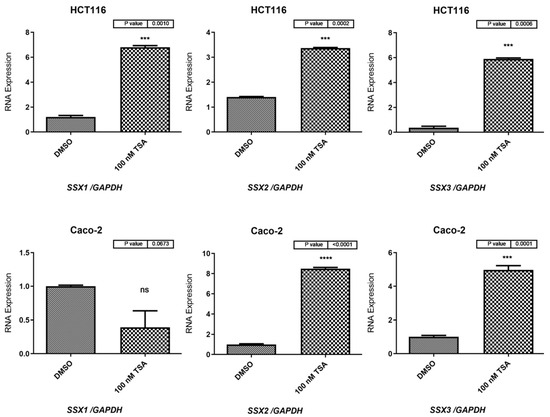 Medicina | Free Full-Text | Higher Expression Levels of SSX1 and SSX2 ...