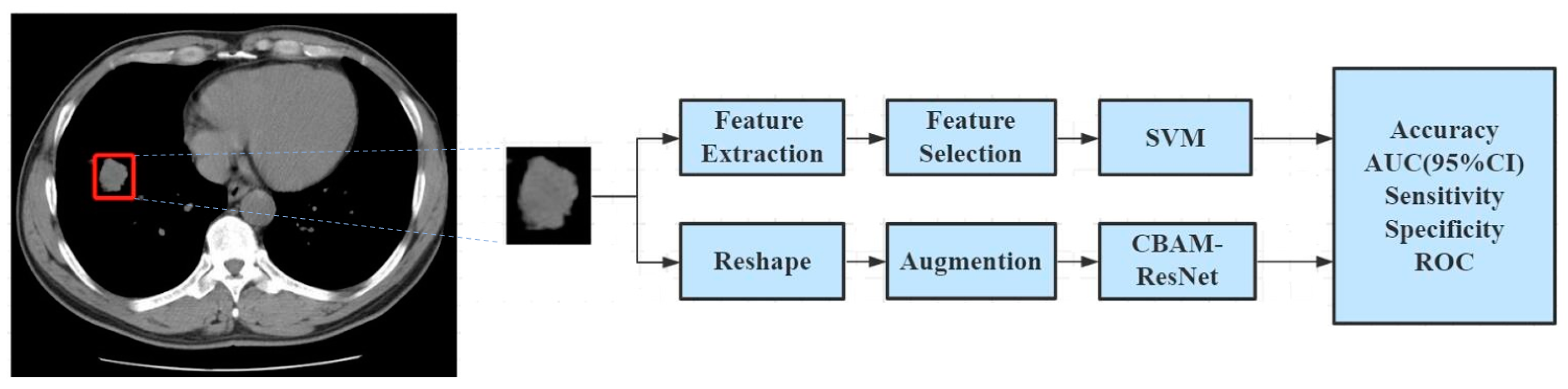 Deep-Learning Model of ResNet Combined with CBAM for Malignant–Benign ...