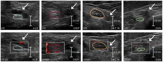 Medicina | Free Full-Text | Peripheral Nerve Ultrasound for the ...