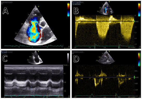 Medicina | Free Full-Text | Multimodality Cardiac Imaging in COVID-19 Infection