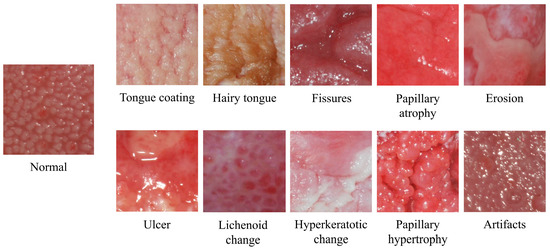 Medicina | Free Full-Text | Detection of Abnormal Changes on the Dorsal ...