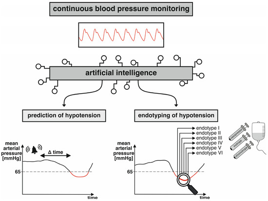 Continuous Blood Pressure Monitoring in Patients Having Surgery: A ...