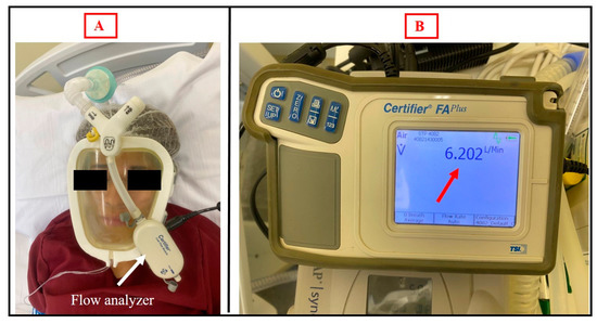 Medicina | Free Full-Text | A New Full-Face Mask for Multifunctional ...