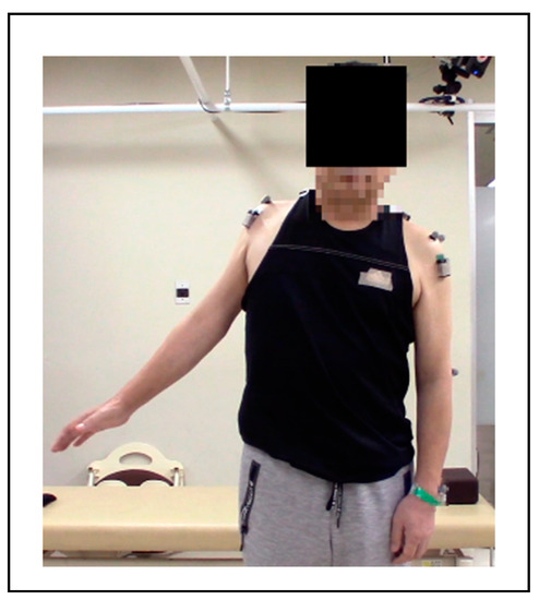 Feasibility and Efficacy of the Newly Developed Robotic Hybrid ...