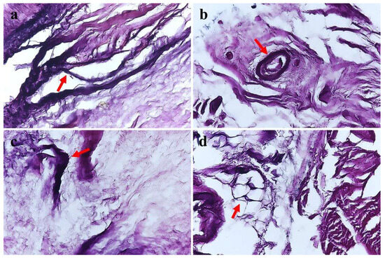 Medicina | Free Full-Text | Is There a Difference in the Distribution ...