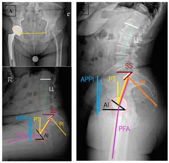 Current Concepts in Diagnosis and Management of Patients Undergoing ...