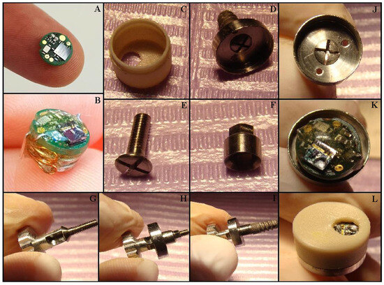 A New Model of Salivary Pacemaker—A Proof of Concept and First Clinical Use