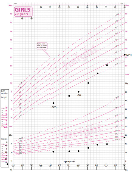 Turner Syndrome Mosaicism after Diagnosis of Coeliac Disease—A High ...