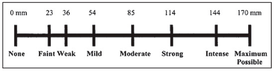 Comparison of Efficacy of Lidocaine and Articaine as Inferior Alveolar ...