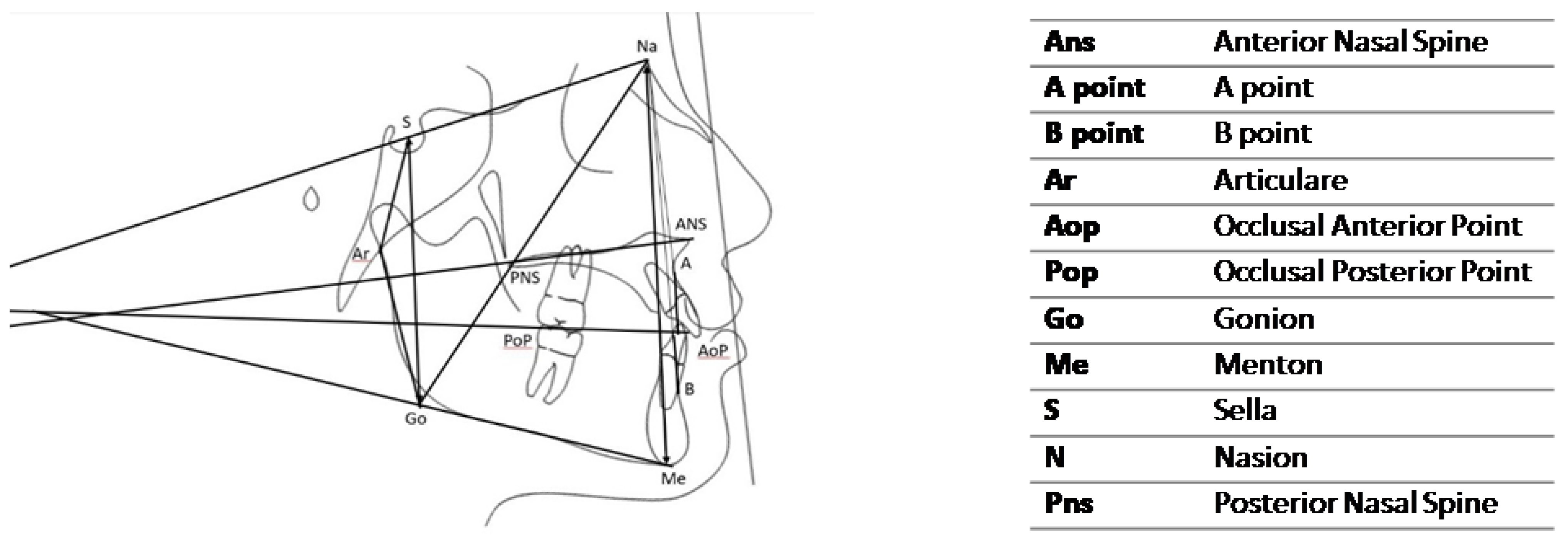 The Correlation between Mandibular Arch Shape and Vertical Skeletal Pattern