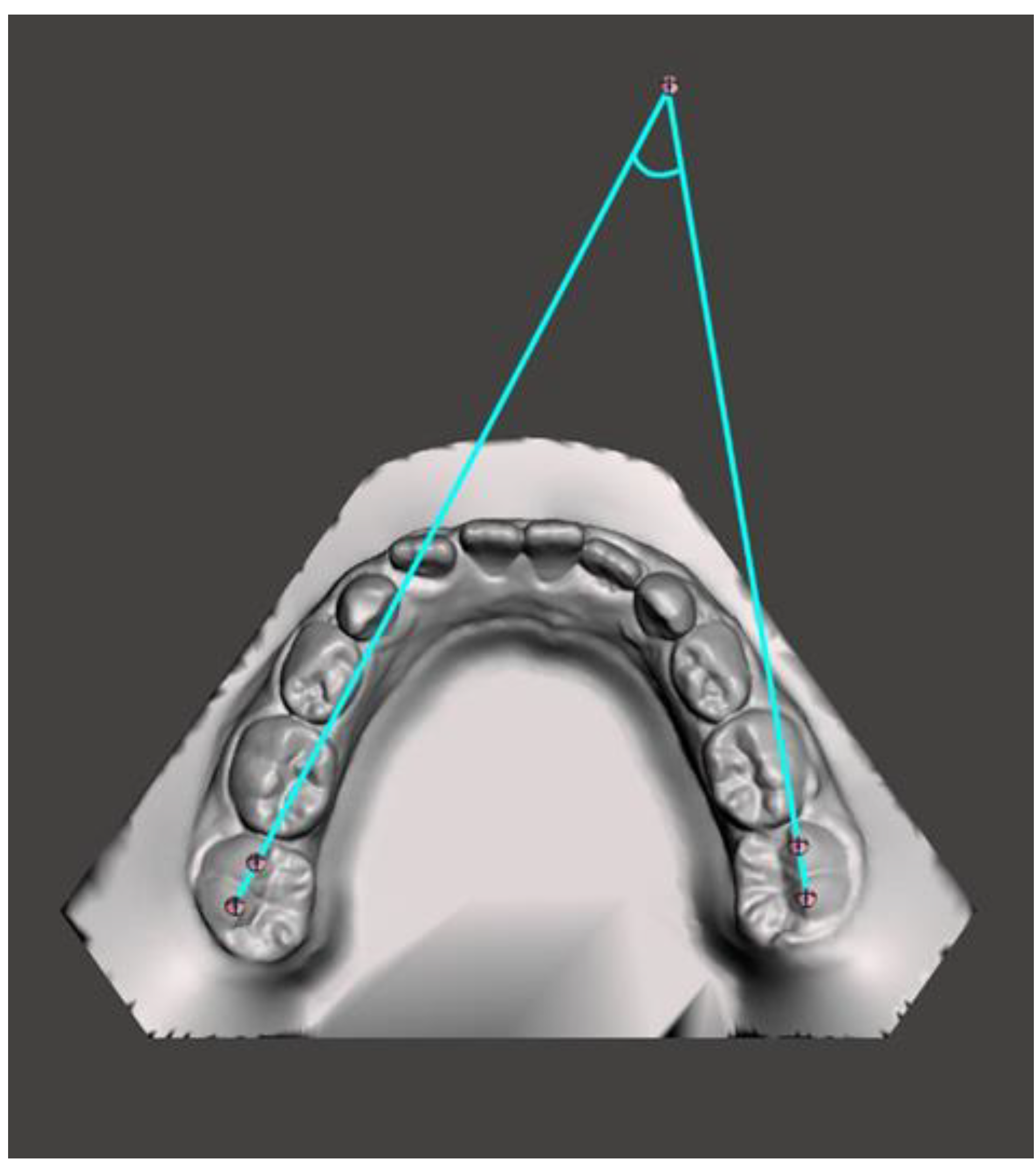 The Correlation between Mandibular Arch Shape and Vertical Skeletal Pattern