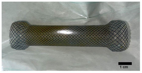 Prevention of Migration of Esophageal Self-Expandable Metallic Stents ...