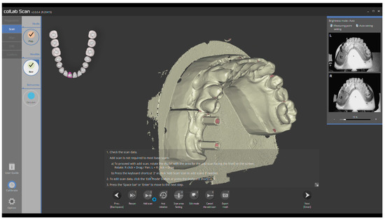 Three-Dimensional Scanning Accuracy of Intraoral Scanners for Dental Implant Scan Bodies—An ...