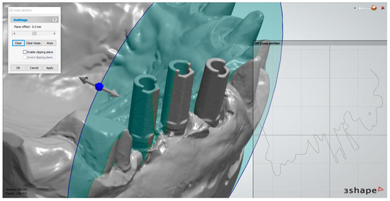 Medicina | Free Full-Text | Three-Dimensional Scanning Accuracy of ...