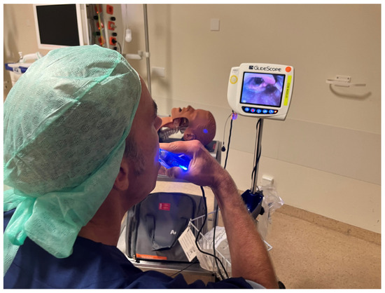 Topical Anaesthesia Using a Soft Mist Spray Device Allows Comfortable ...