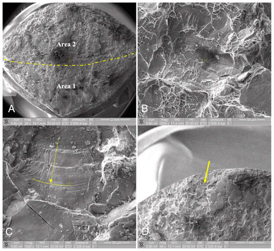 Medicina | Free Full-Text | Gross Taper Failure and Fracture of the ...
