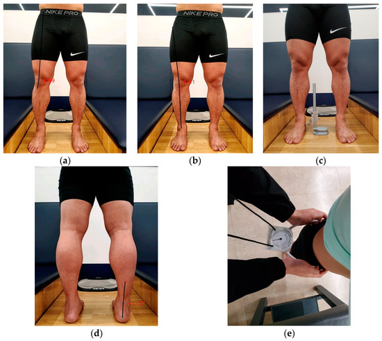 Comparison of Lower Extremity Alignment among Taekwondo Athletes of ...
