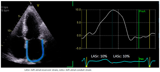 The Clinical Applications of Left Atrial Strain: A Comprehensive Review