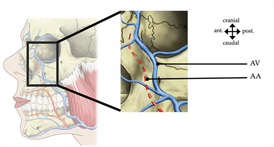 Course and Relation of the Facial Vessels—An Anatomical Study