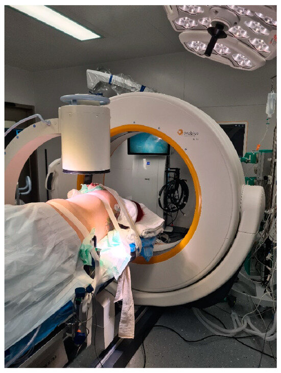 Surgical Treatment of Calcified Thoracic Herniated Disc Disease via the ...