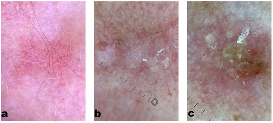 Medicina Free Full Text An Update On Non Invasive Skin Imaging