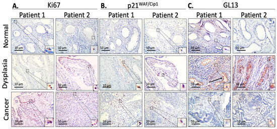 Medicina Free Full Text Cellular Senescence In Germ Cell Neoplasia