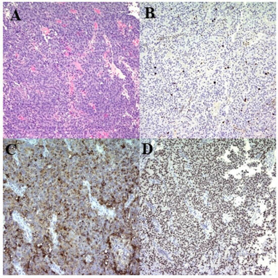 Feasibility of Early Surgical Treatment for Adolescent Patients with ...