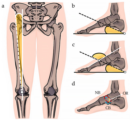 Effects of Rhythm Step Training on Foot and Lower Limb Balance in ...