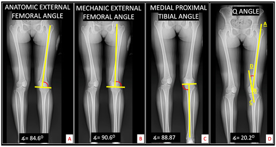 Miodynamic and Radiographic Evaluation in Recreative Athletes with ...